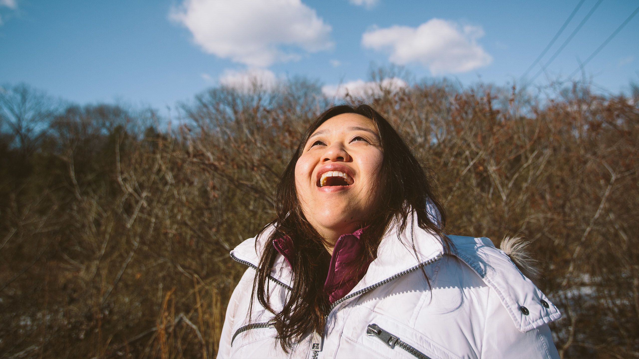 Living With Psoriasis: Amy Woo